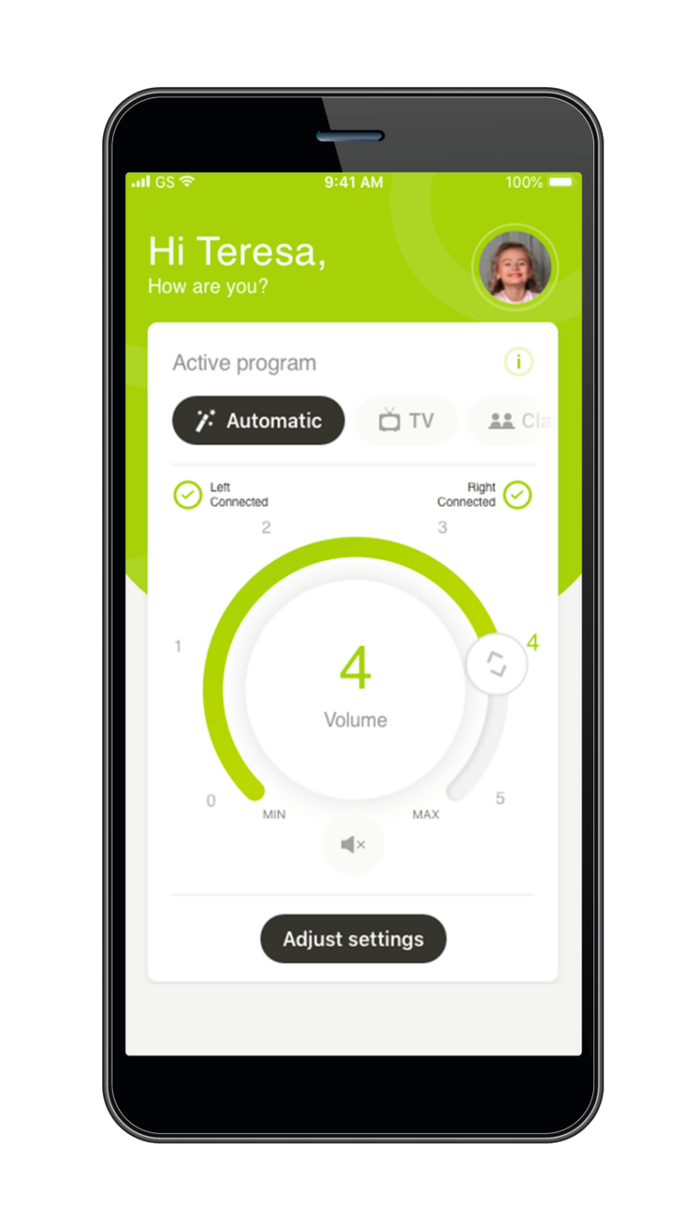 Solution for Hearing Loss in One Ear (Unilateral) - CROS Lumity Hearing Aids | Phonak