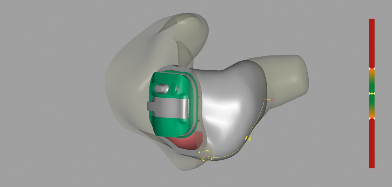 For professionals - Virto Marvel Hearing Aid | Phonak