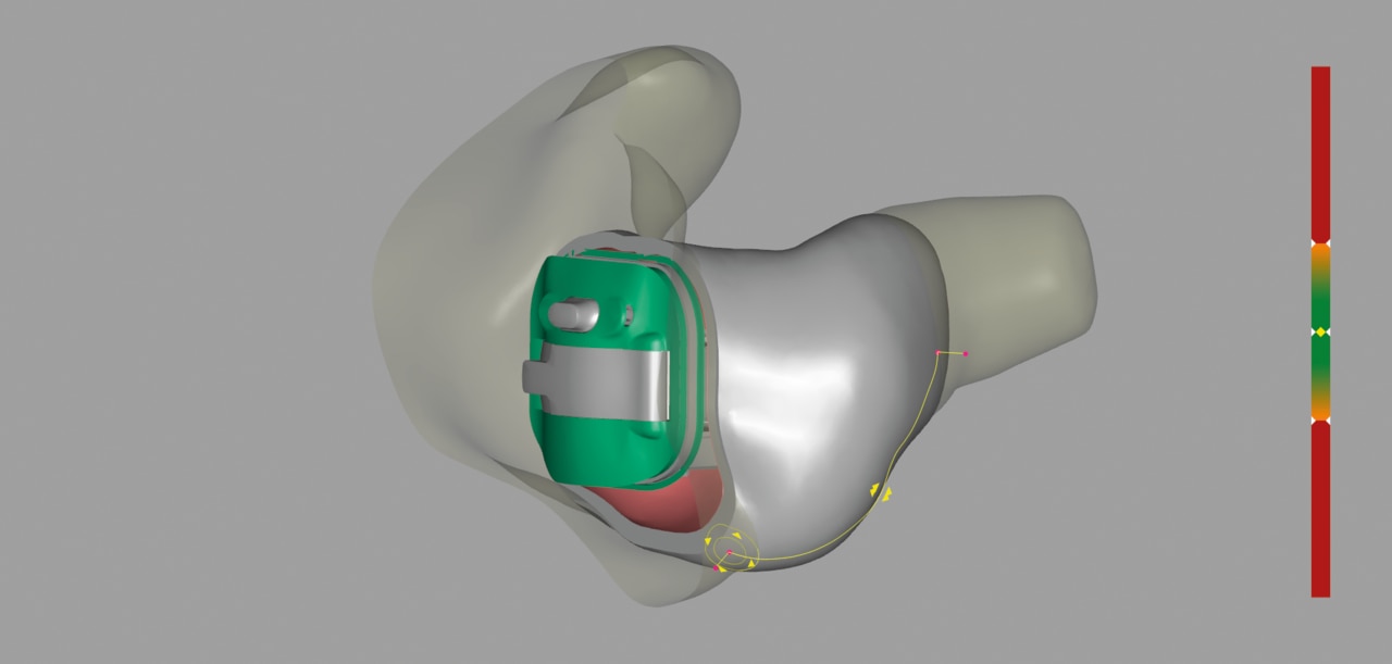 For professionals - Virto Marvel Hearing Aid | Phonak